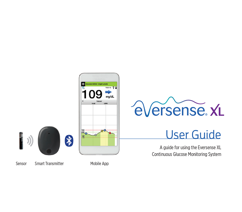 Eversense Support